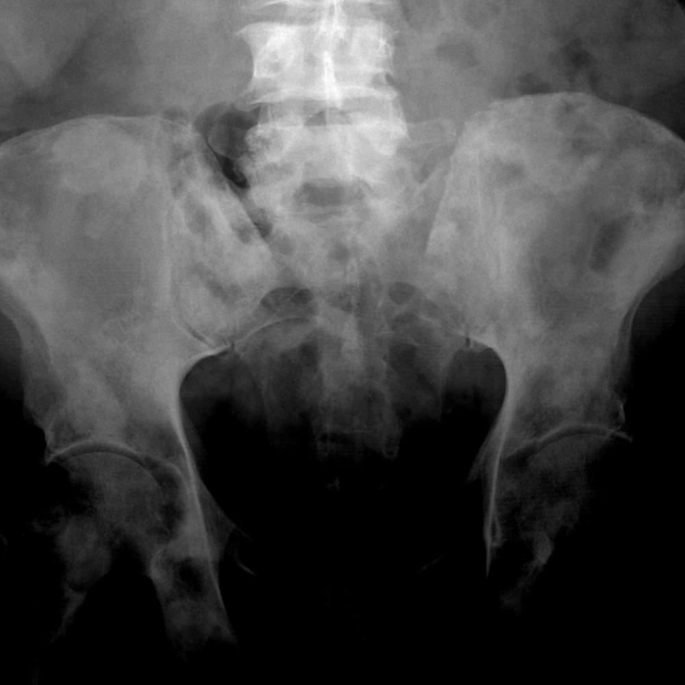 Case #13 - CaseStacks.com