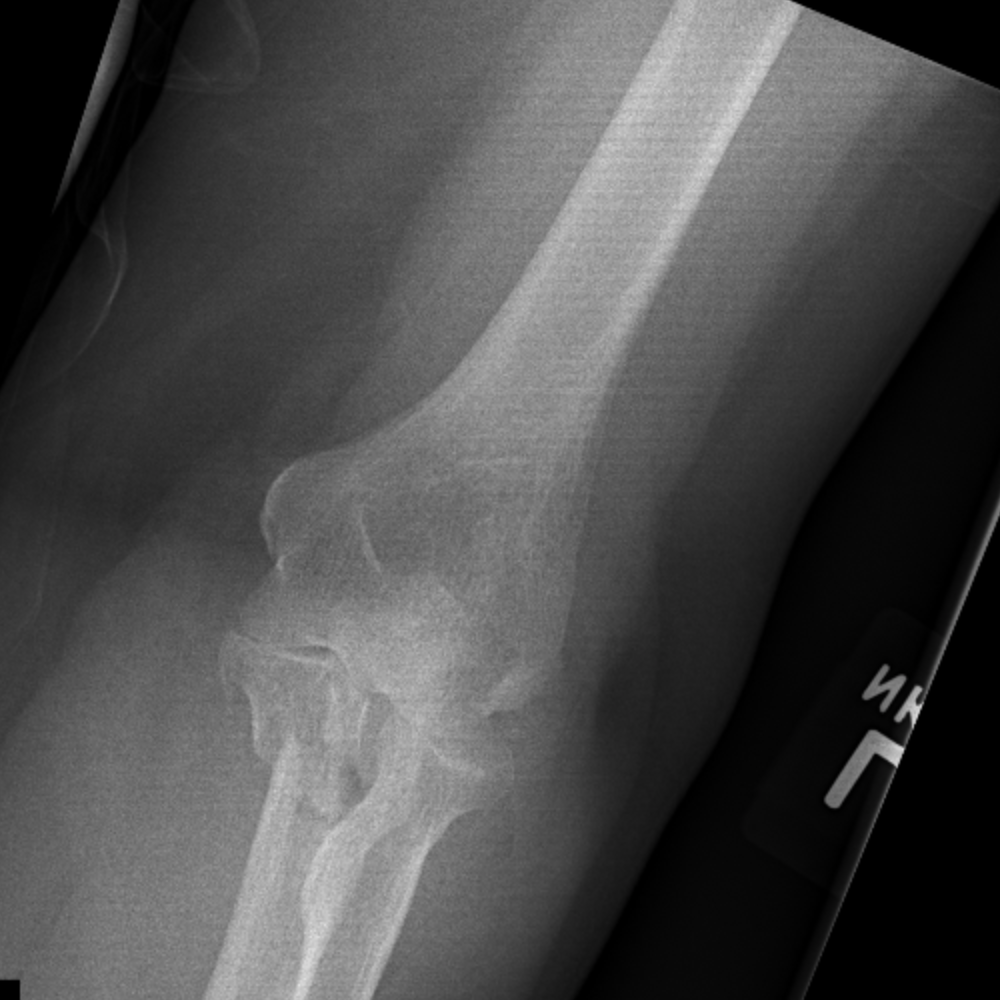 Case #14 - CaseStacks.com