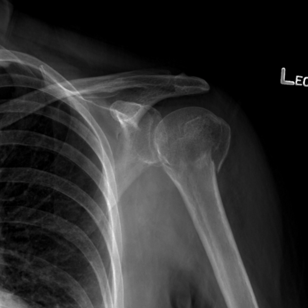 CaseStacks.com - MSK Radiograph Case #14