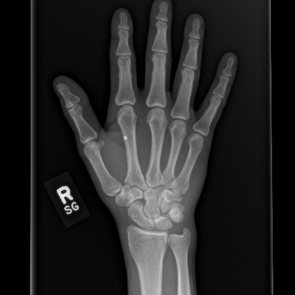 Case #16 - CaseStacks.com