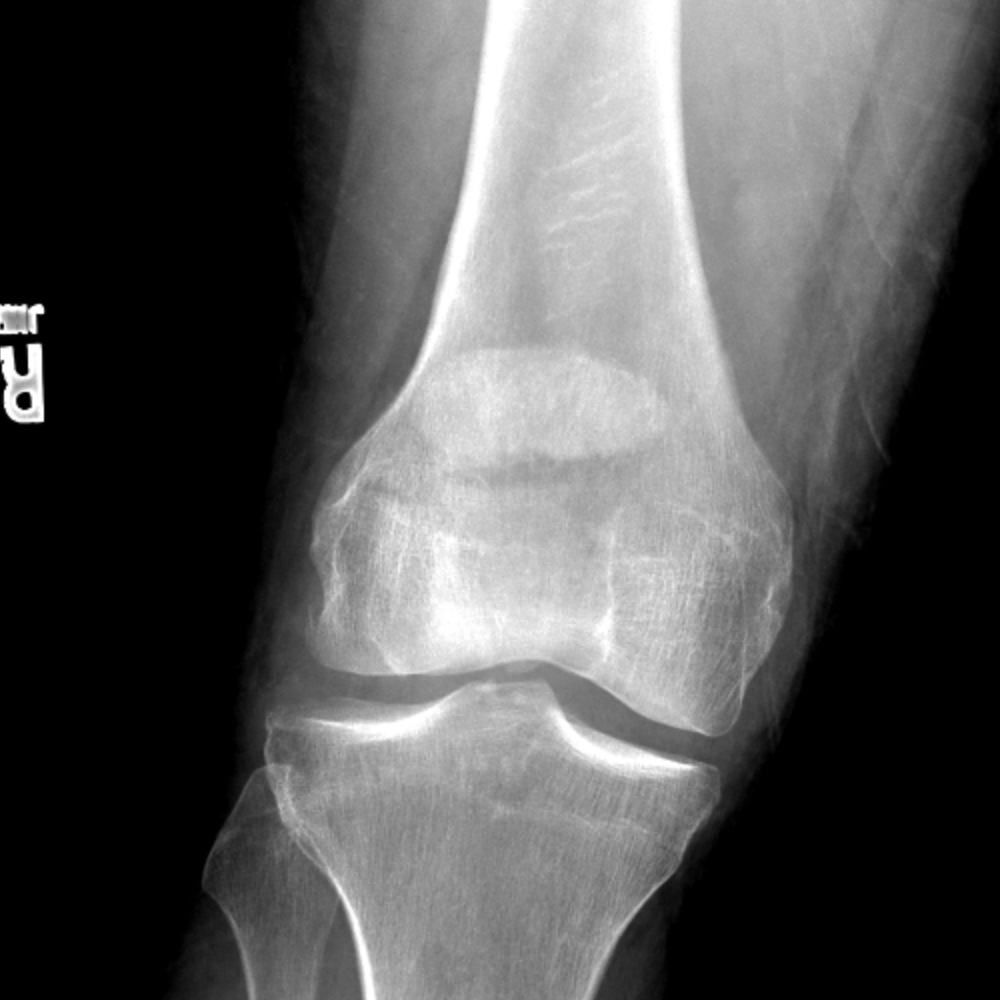 Case #16 - CaseStacks.com