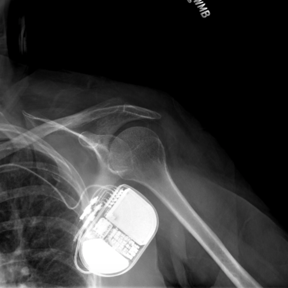 CaseStacks.com - MSK Radiograph Case #17