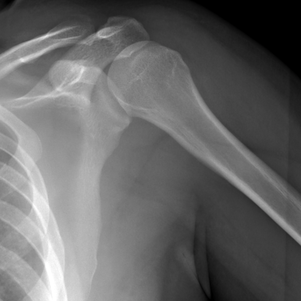 Case #19 - CaseStacks.com