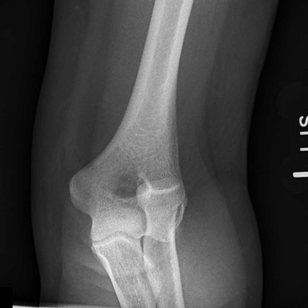 Case #20 - CaseStacks.com