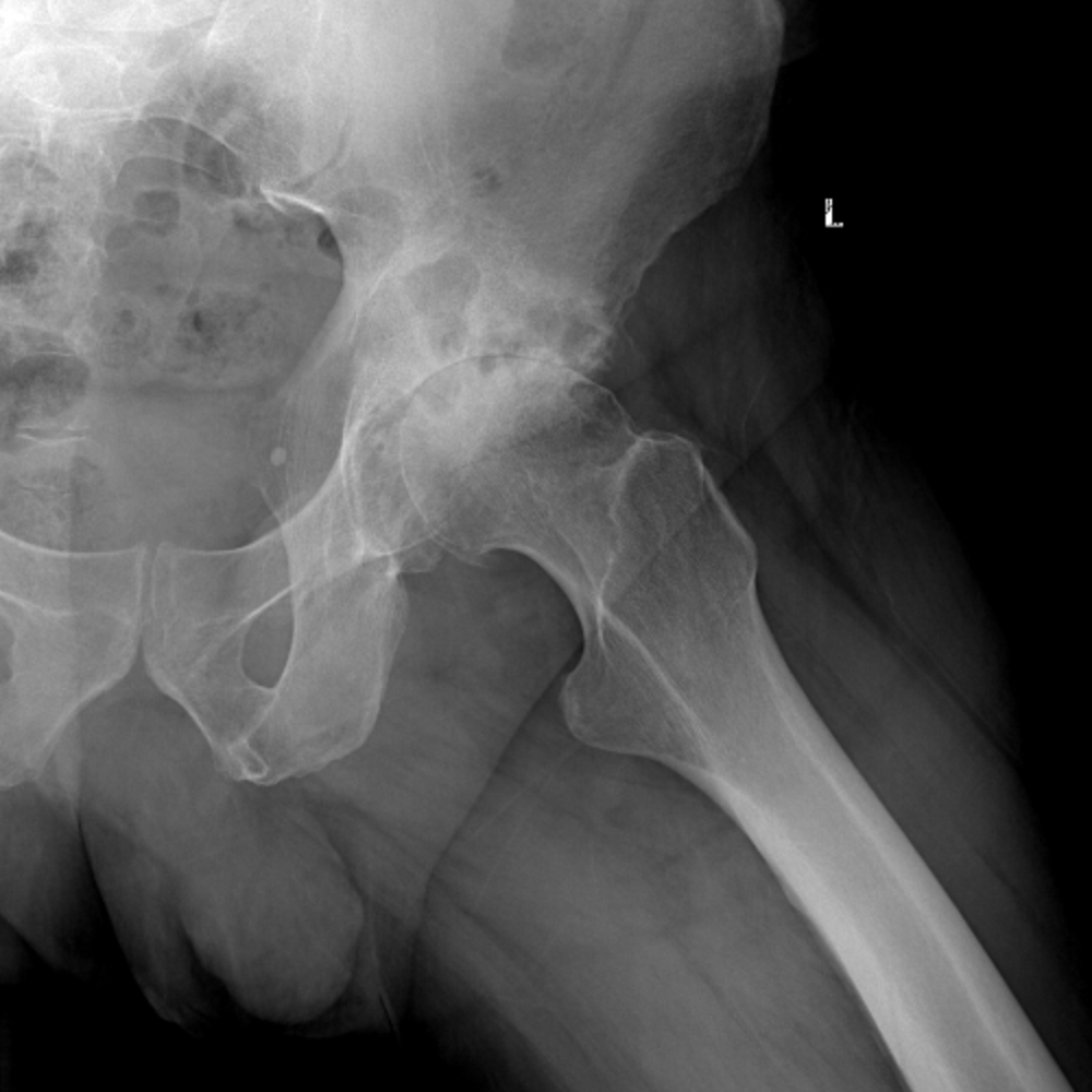 Case #20 - CaseStacks.com