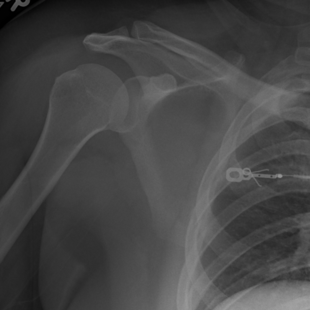 Case #20 - CaseStacks.com