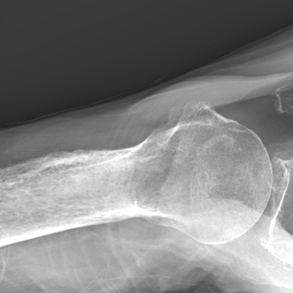 Case #21 - CaseStacks.com