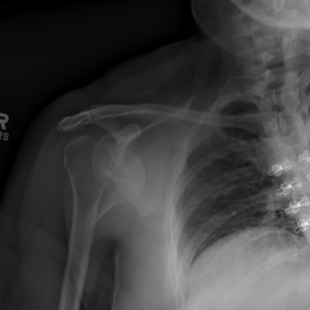 Case #22 - CaseStacks.com