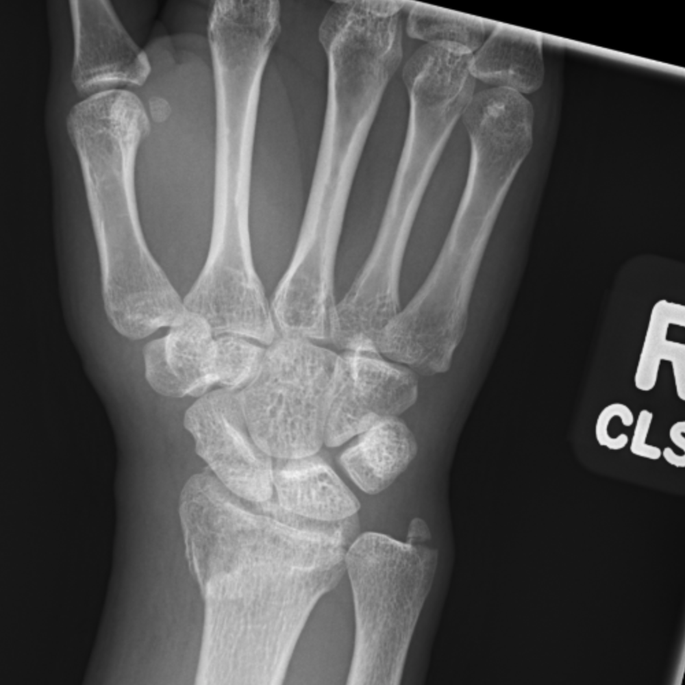 Case #23 - CaseStacks.com