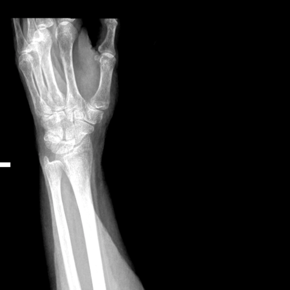 CaseStacks.com - MSK Radiograph Case #25