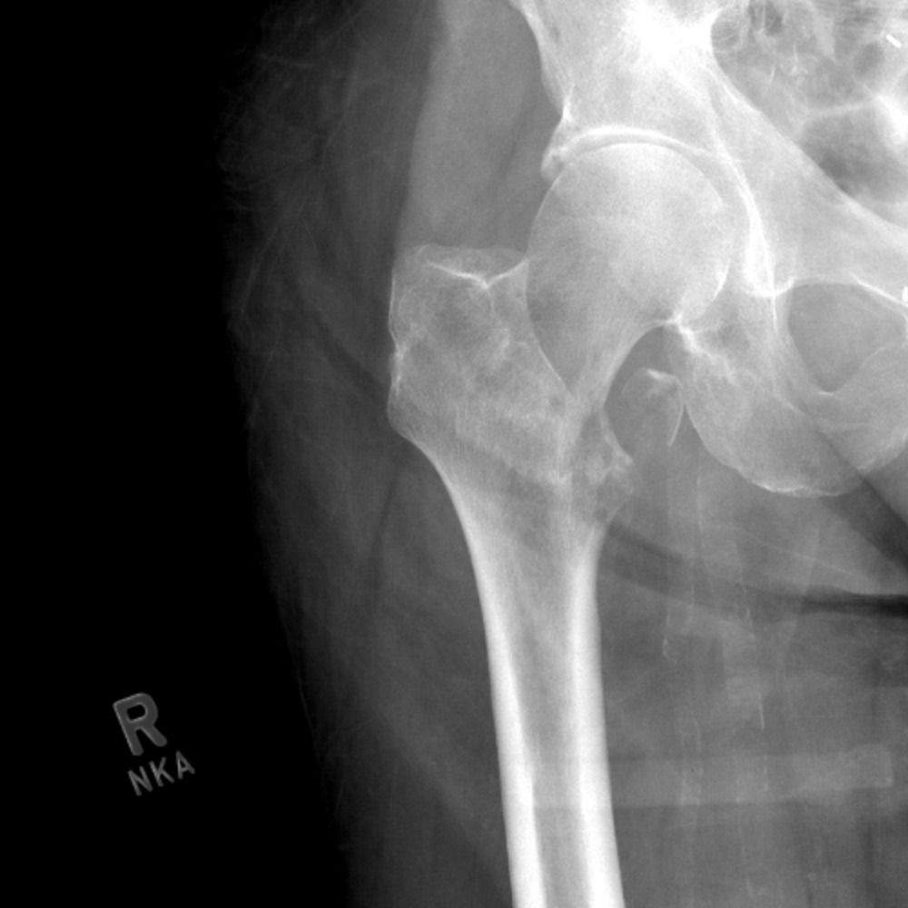 Case #25 - CaseStacks.com