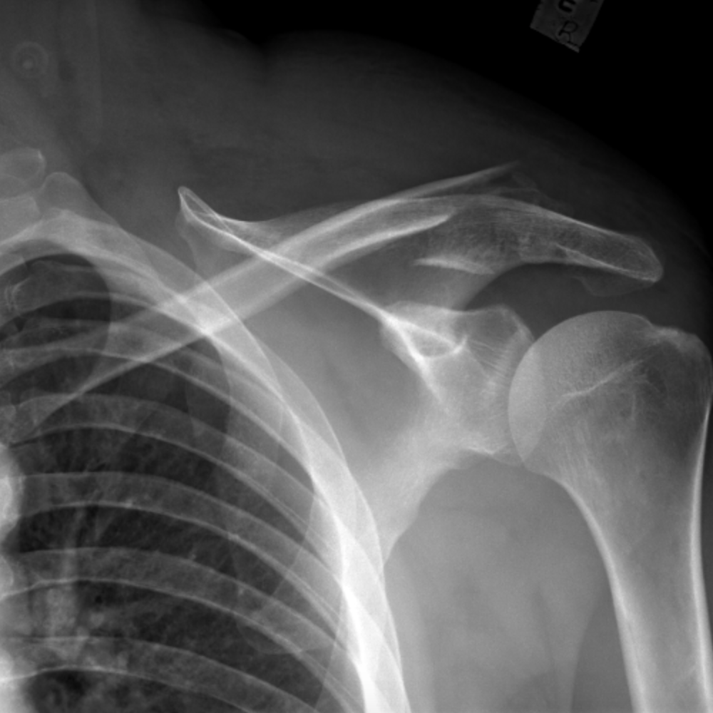 Case #25 - CaseStacks.com