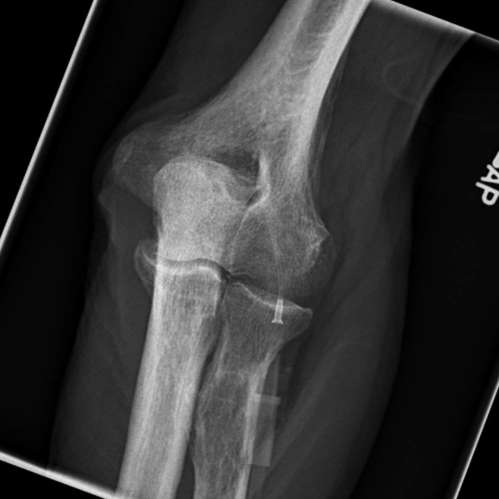 Case #26 - CaseStacks.com