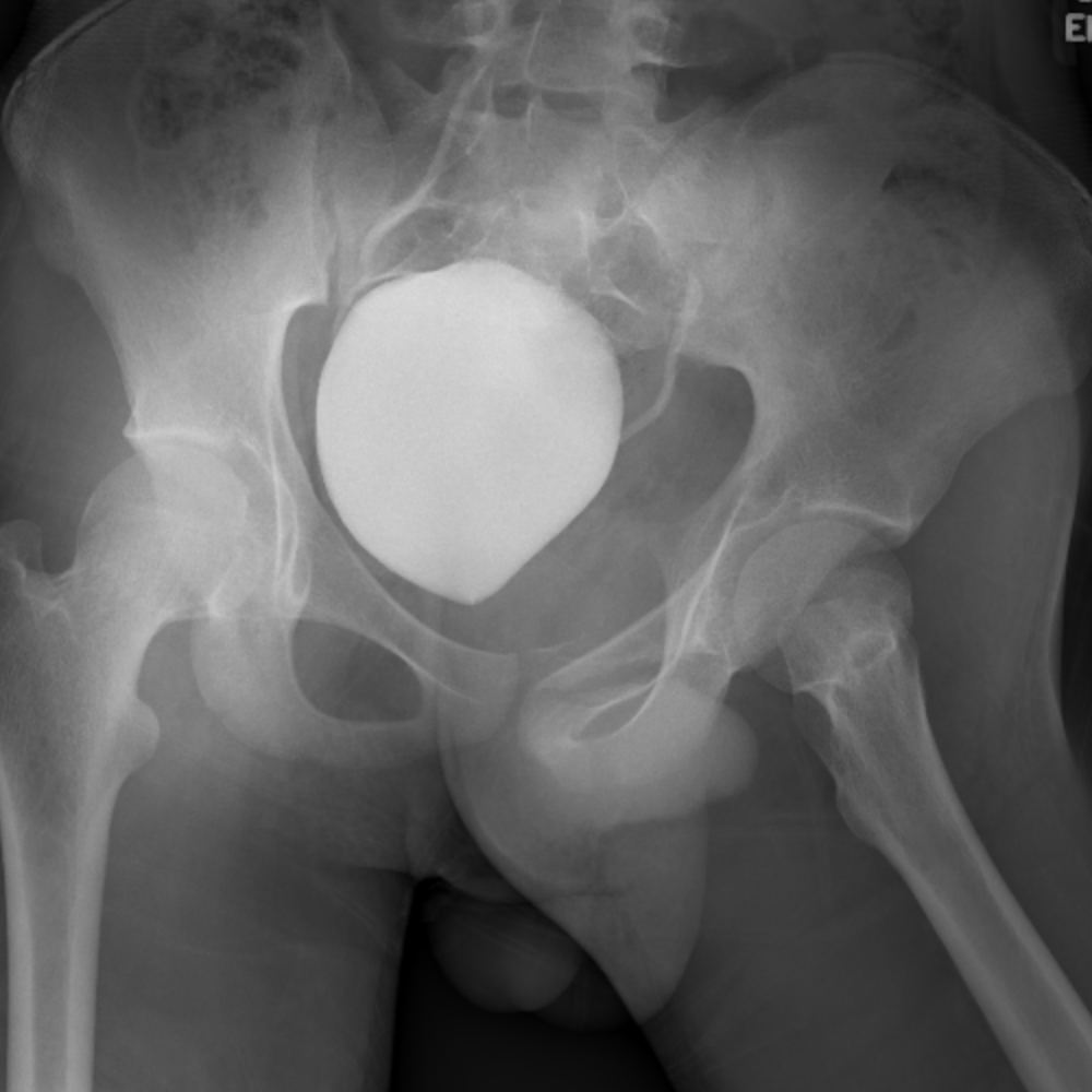 CaseStacks.com - MSK Radiograph Case #26