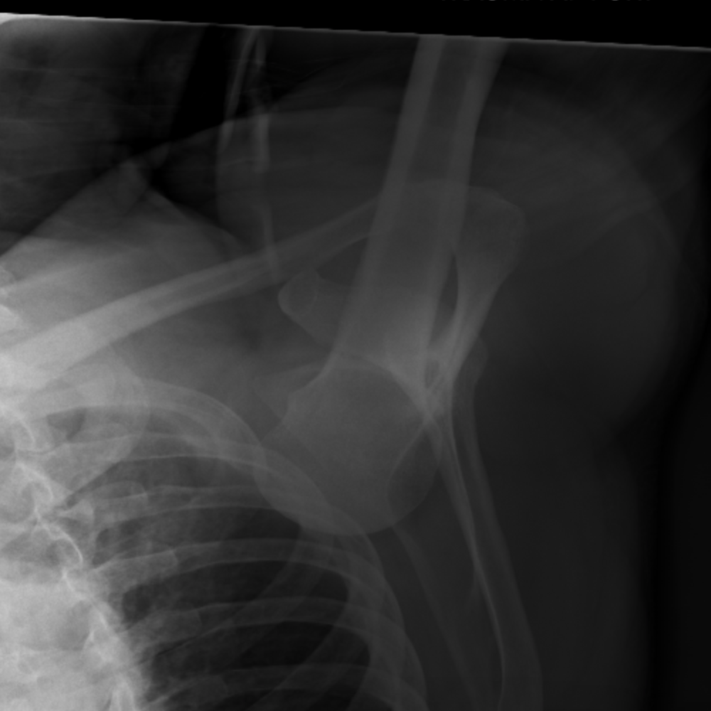 CaseStacks.com - MSK Radiograph Case #26