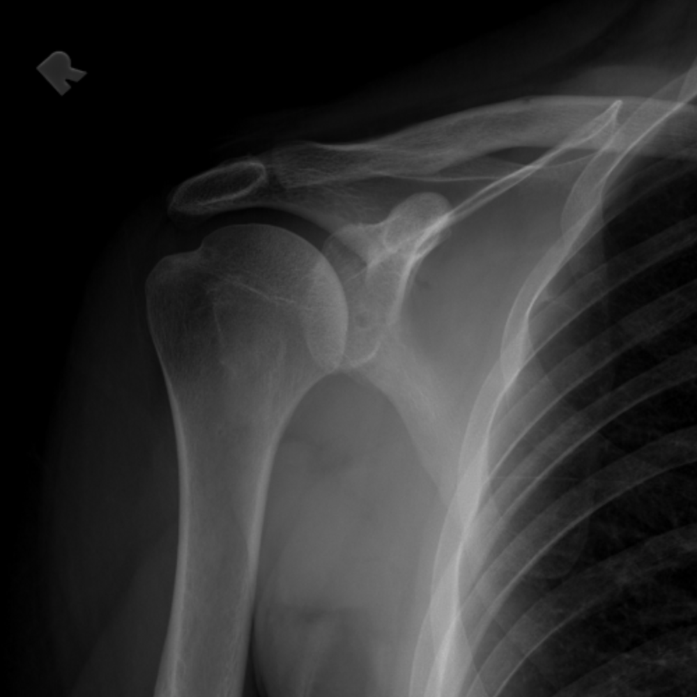 CaseStacks.com - MSK Radiograph Case #27