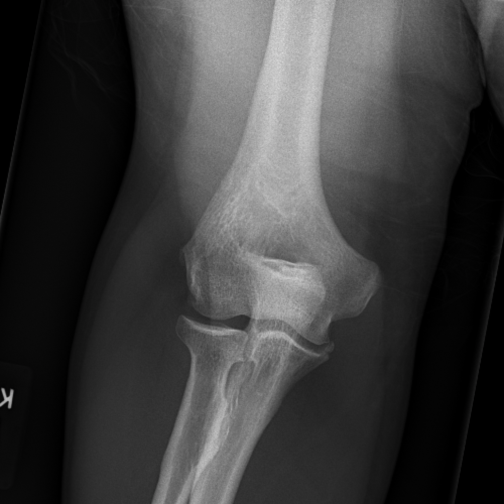 CaseStacks.com - MSK Radiograph Case #28