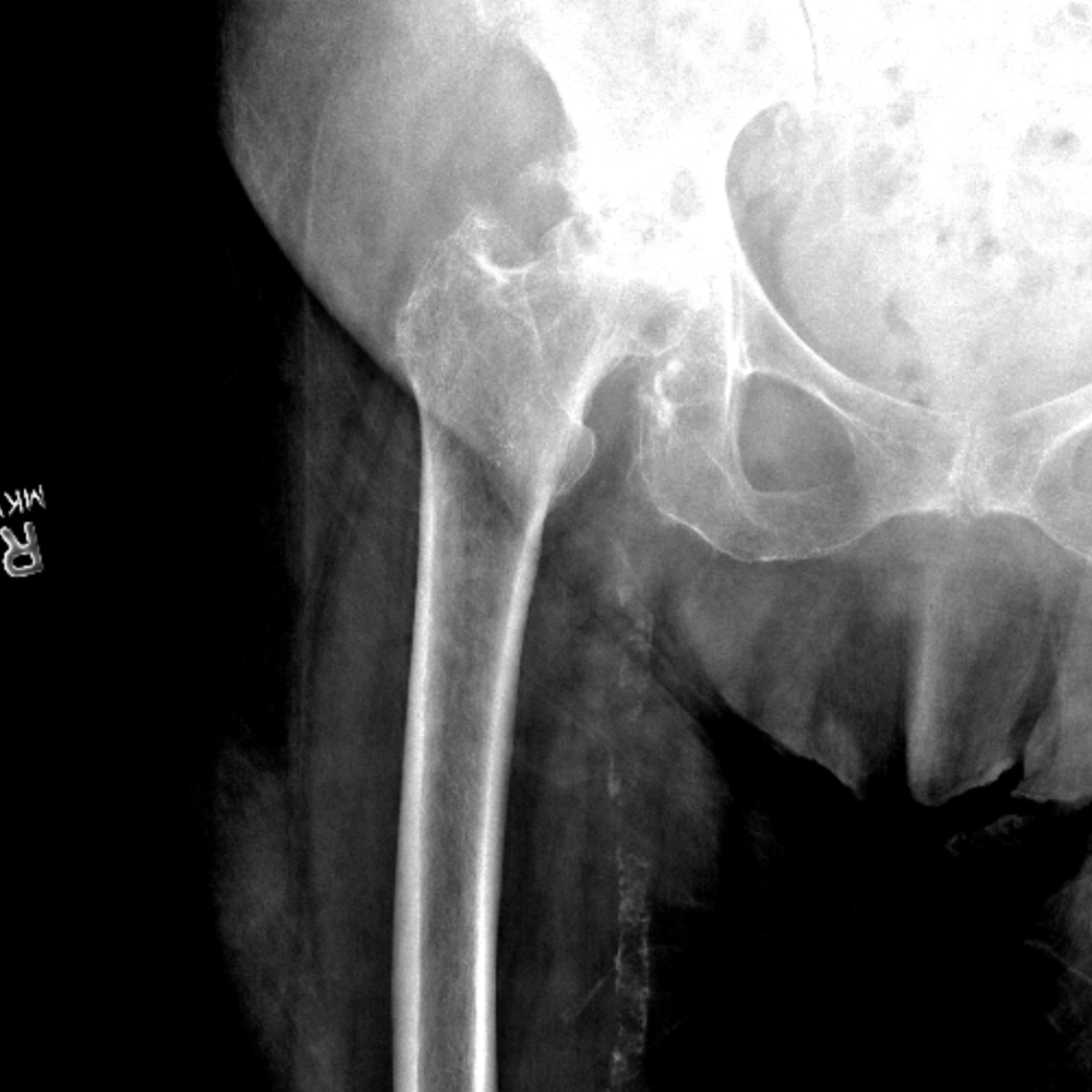 Case #28 - CaseStacks.com