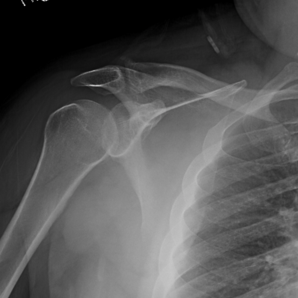 CaseStacks.com - MSK Radiograph Case #28