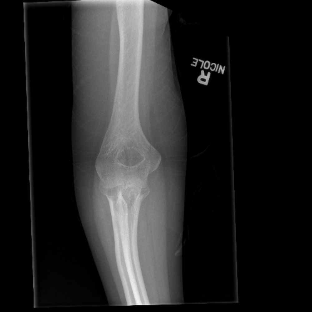 Case #29 - CaseStacks.com