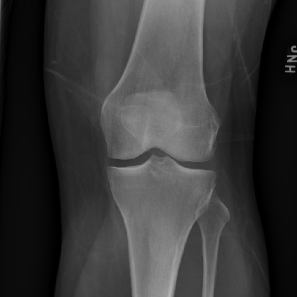 Case #29 - CaseStacks.com