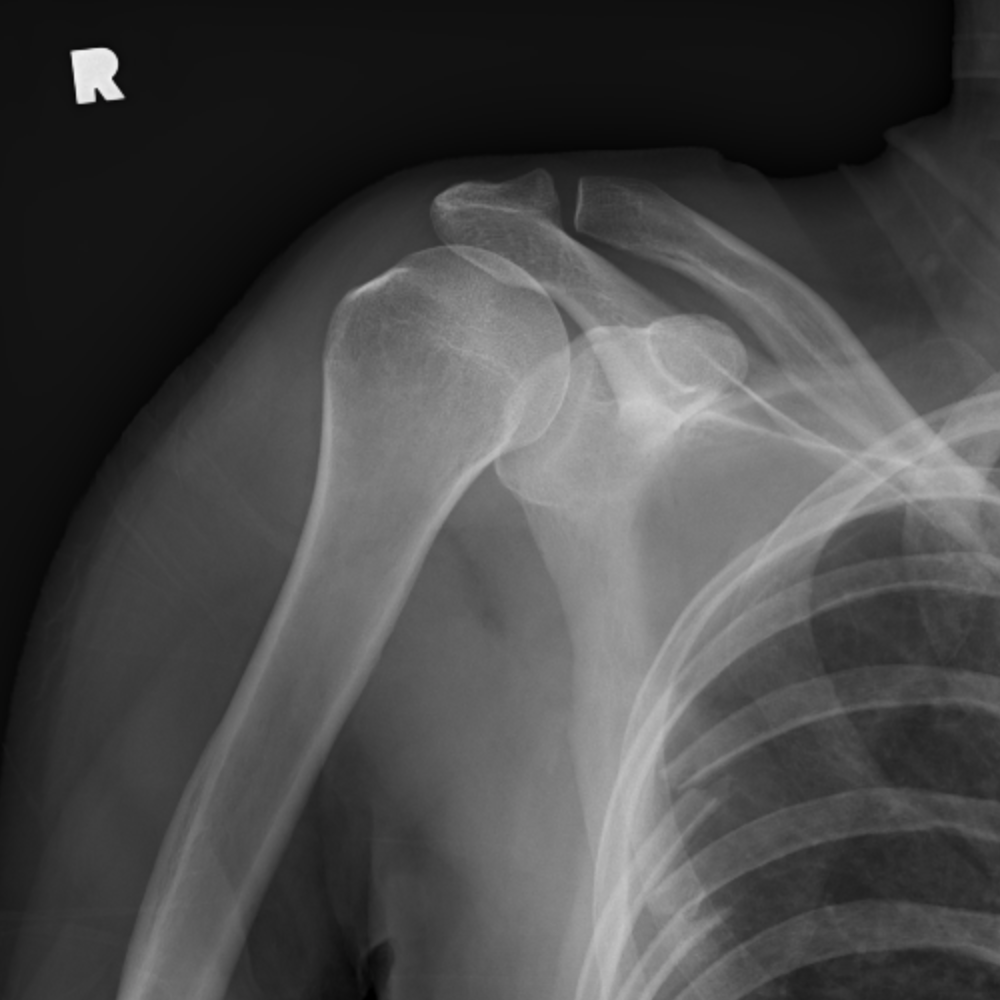 Case #29 - CaseStacks.com