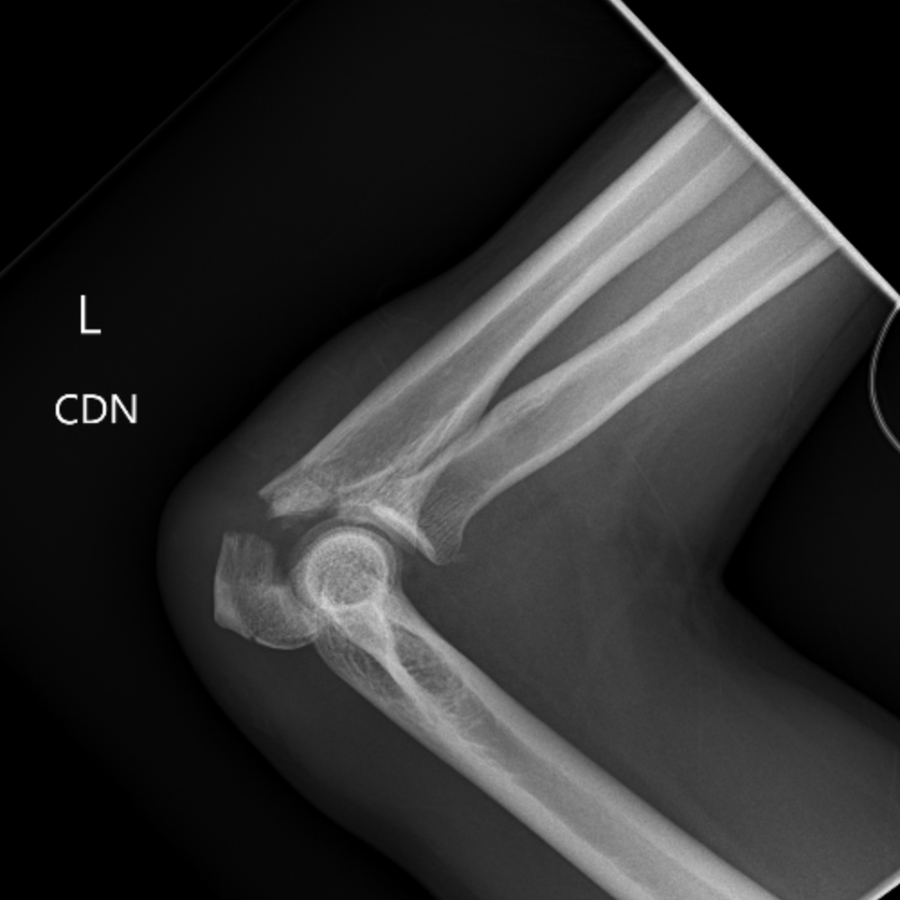 Case #3 - CaseStacks.com