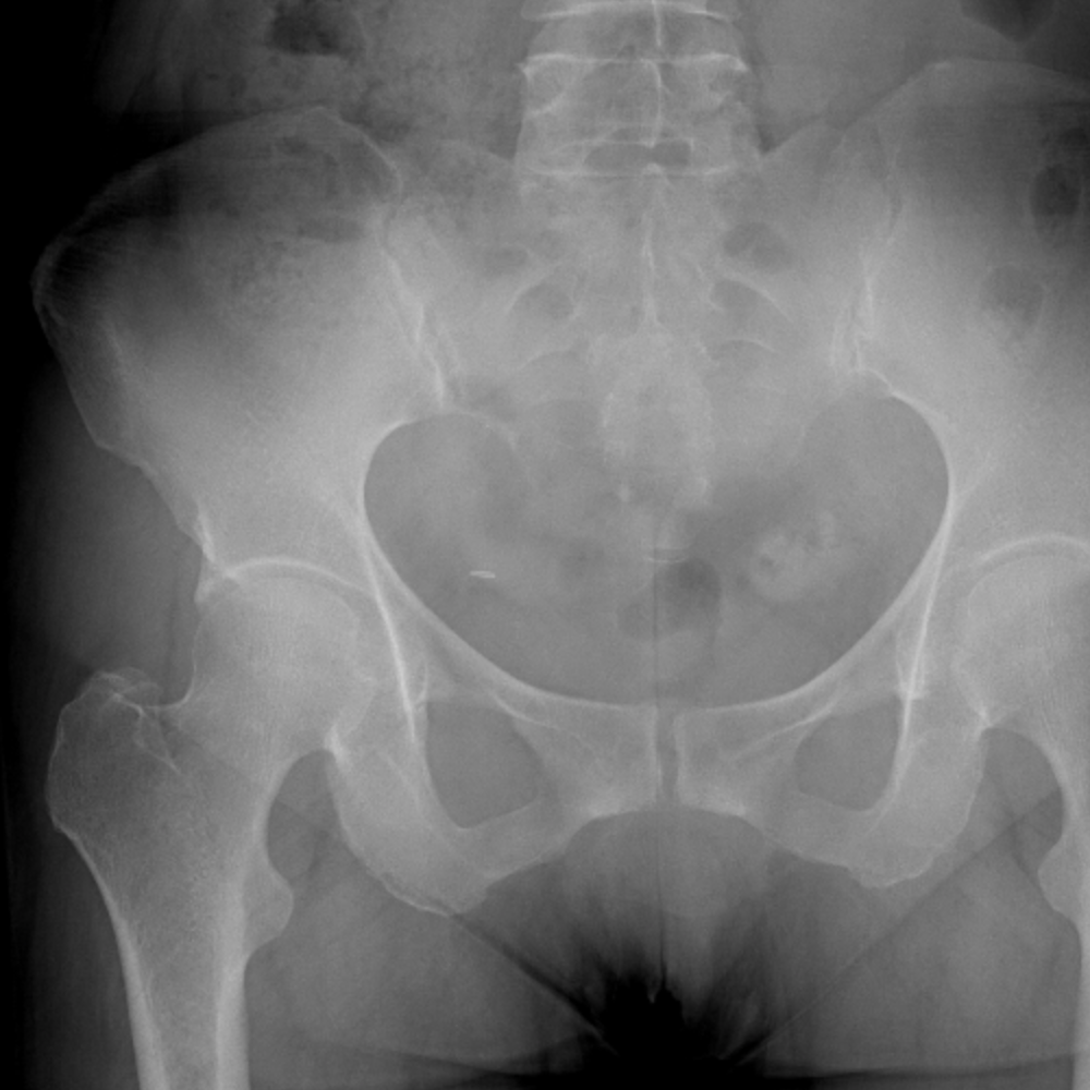 Case #3 - CaseStacks.com