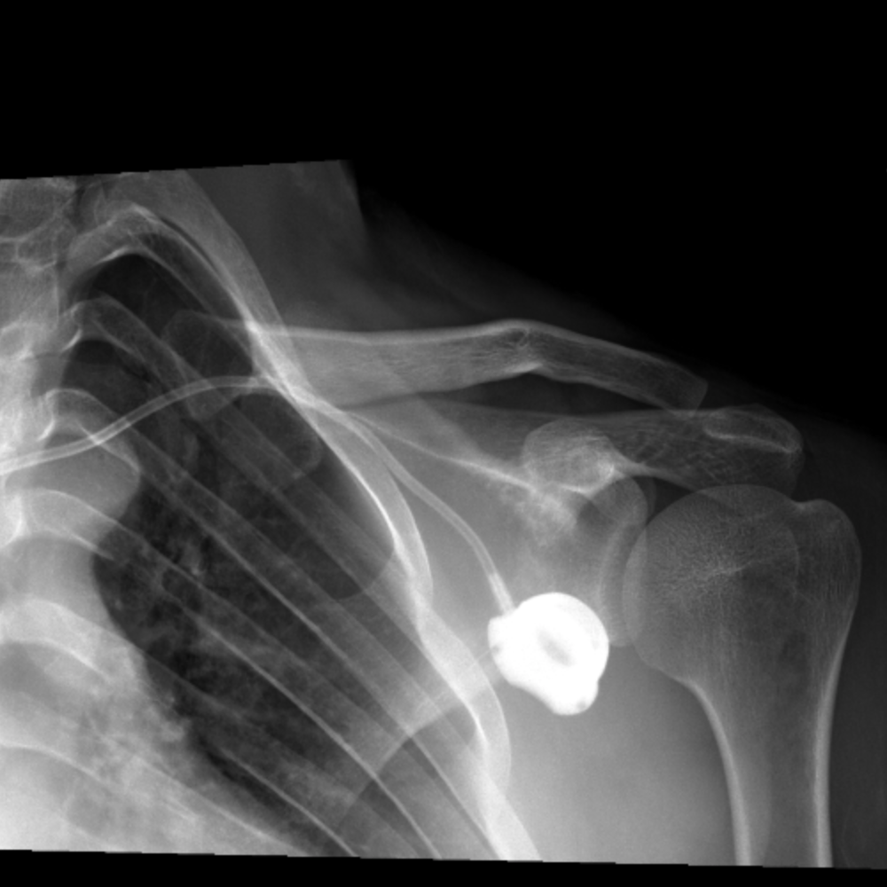 Case #3 - CaseStacks.com