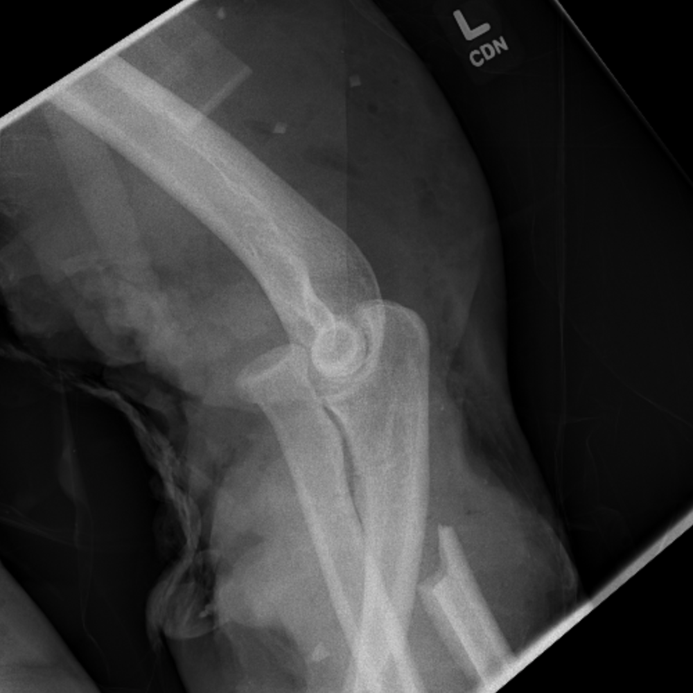 Case #4 - CaseStacks.com