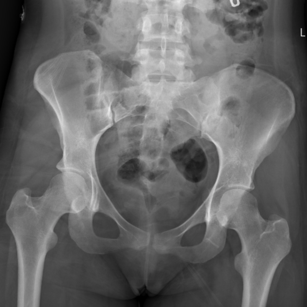 Case #5 - CaseStacks.com