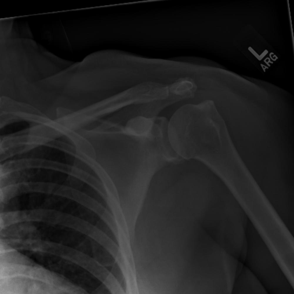 Case #7 - CaseStacks.com