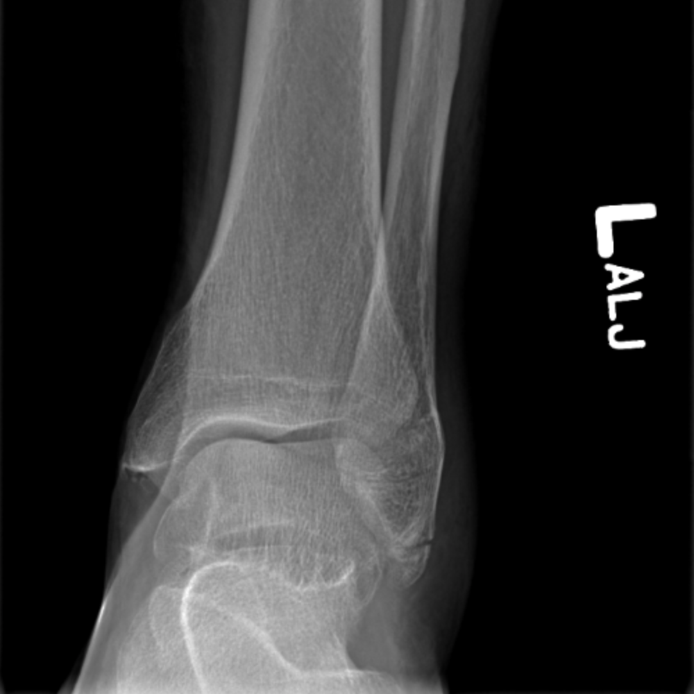 Case #8 - CaseStacks.com