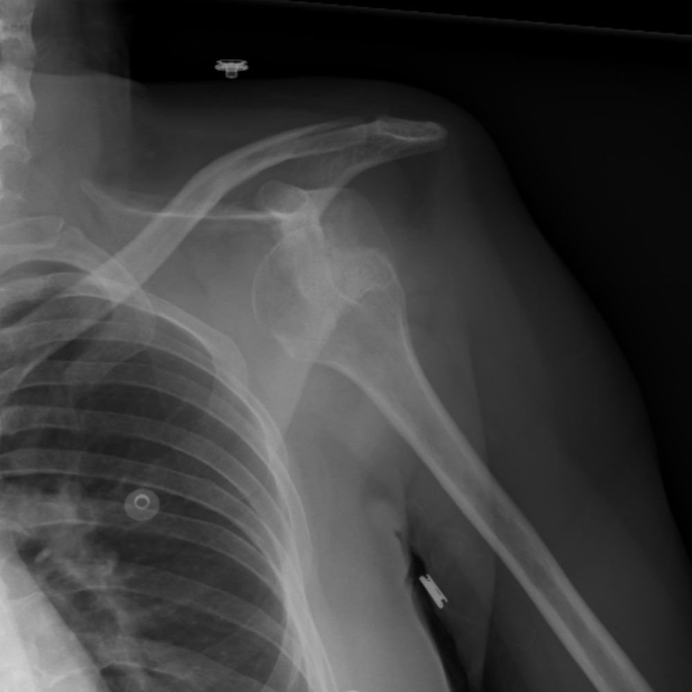 Case #8 - CaseStacks.com