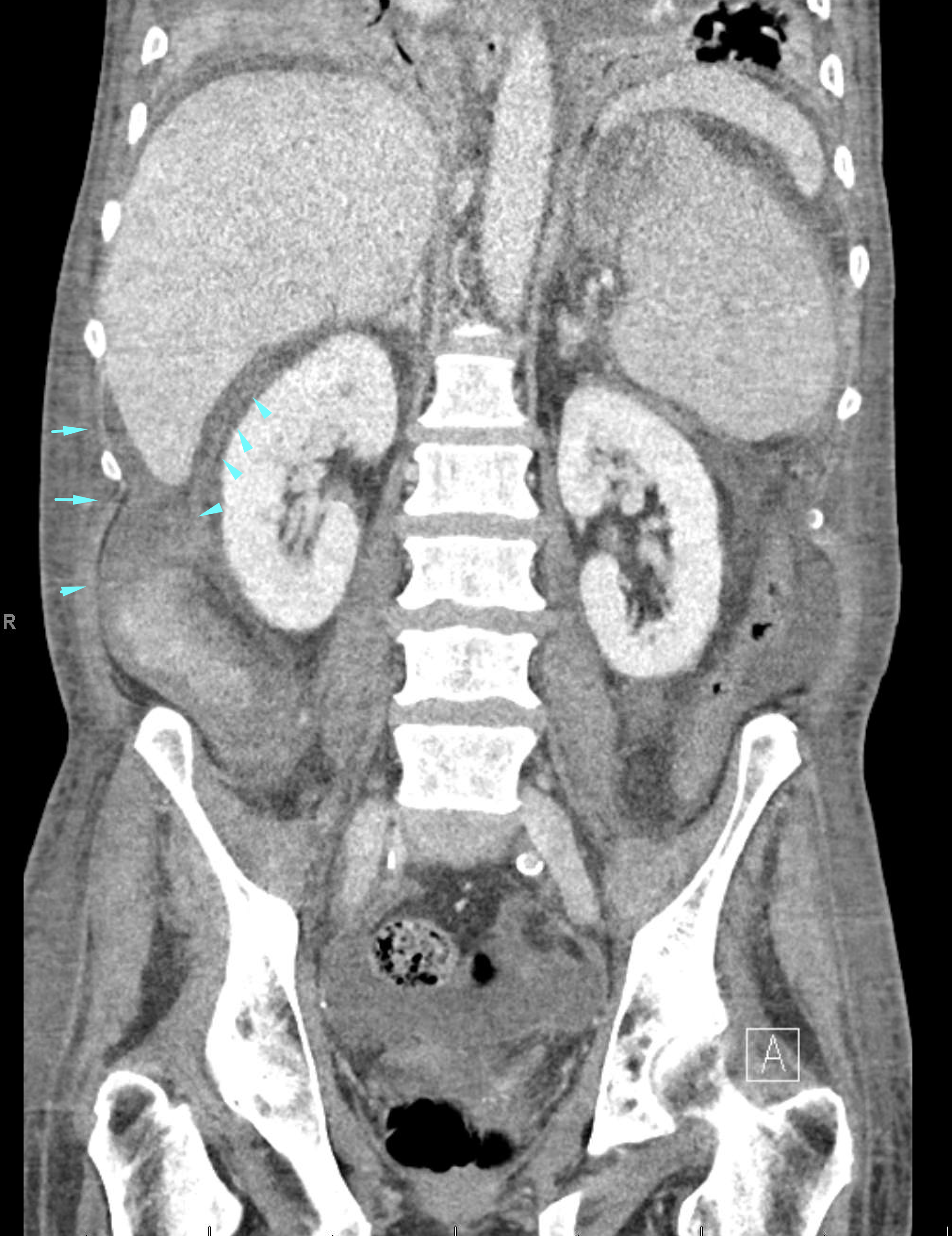 Case #4 | CaseStacks.com