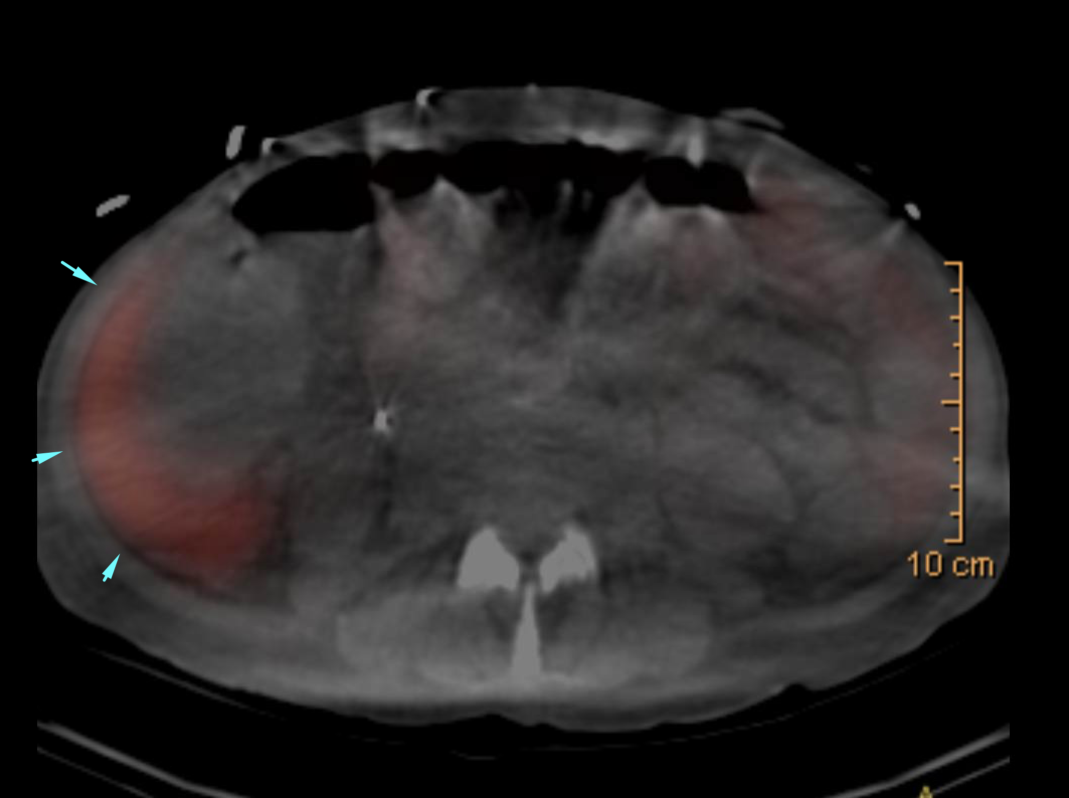 Case #4 | CaseStacks.com