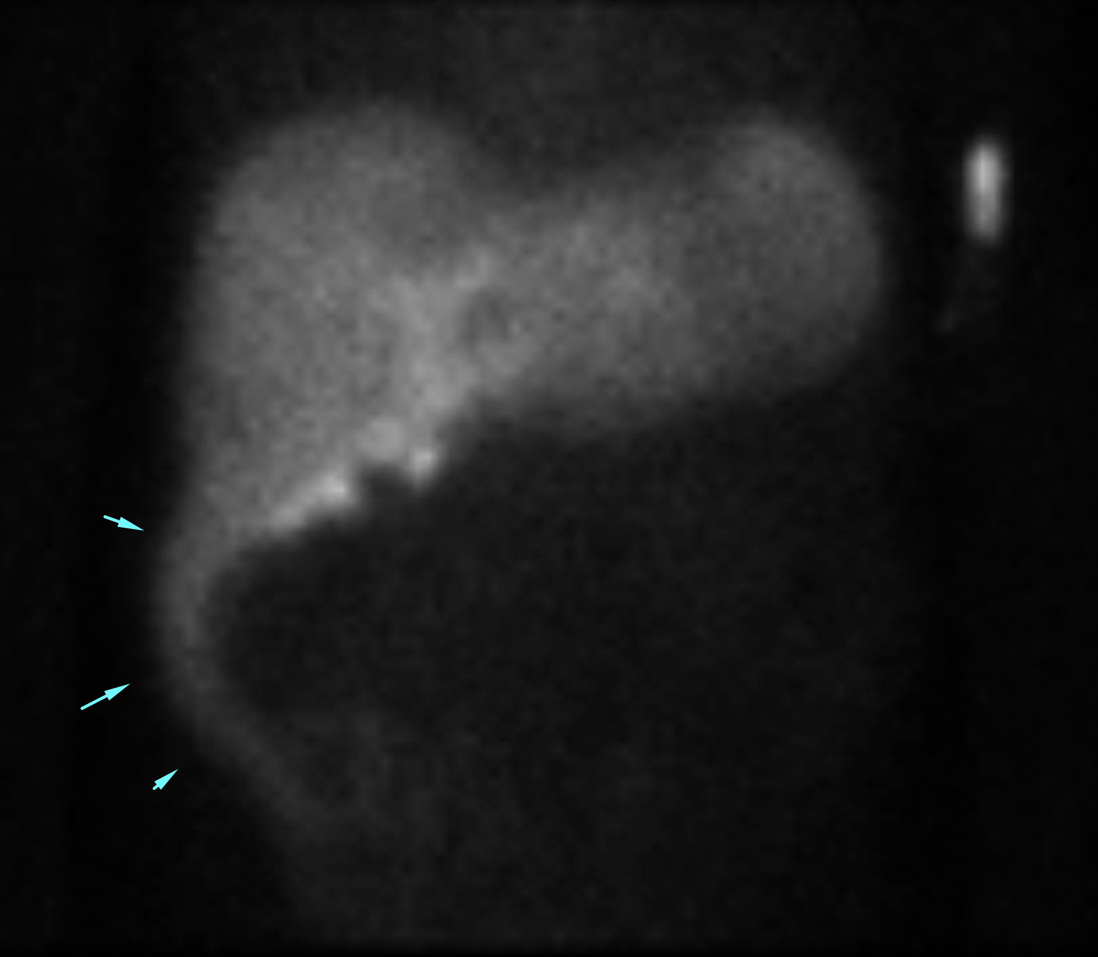 Case #4 | CaseStacks.com