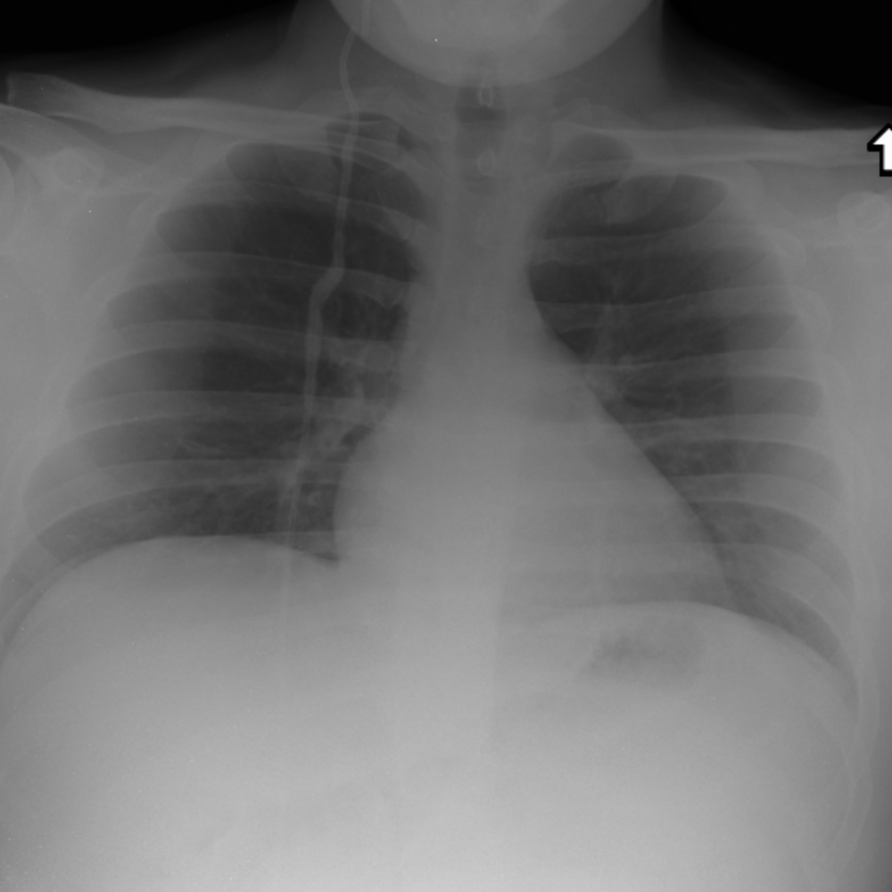 Case #45 - CaseStacks.com