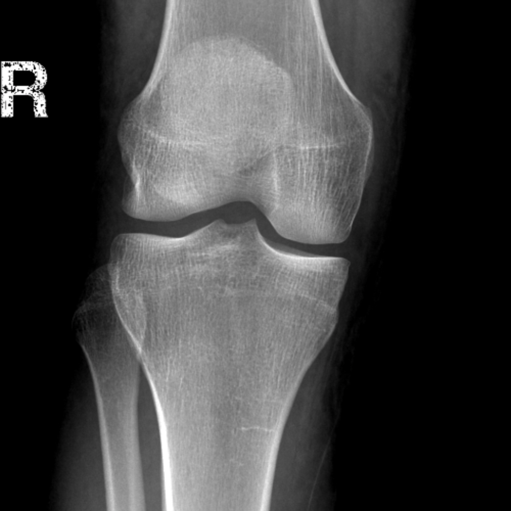 CaseStacks.com - MSK Radiograph Case #6