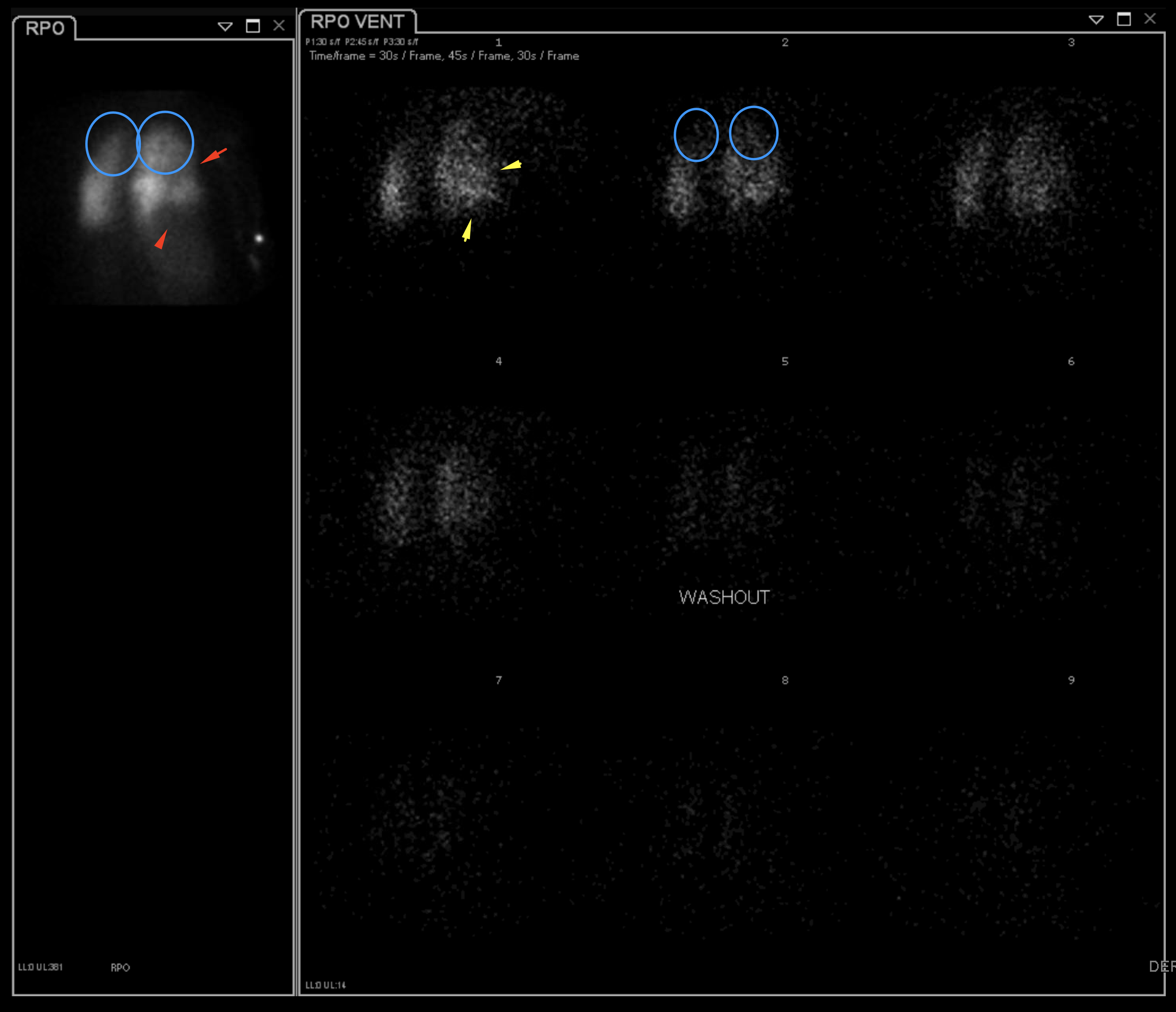 Case #2 | CaseStacks.com