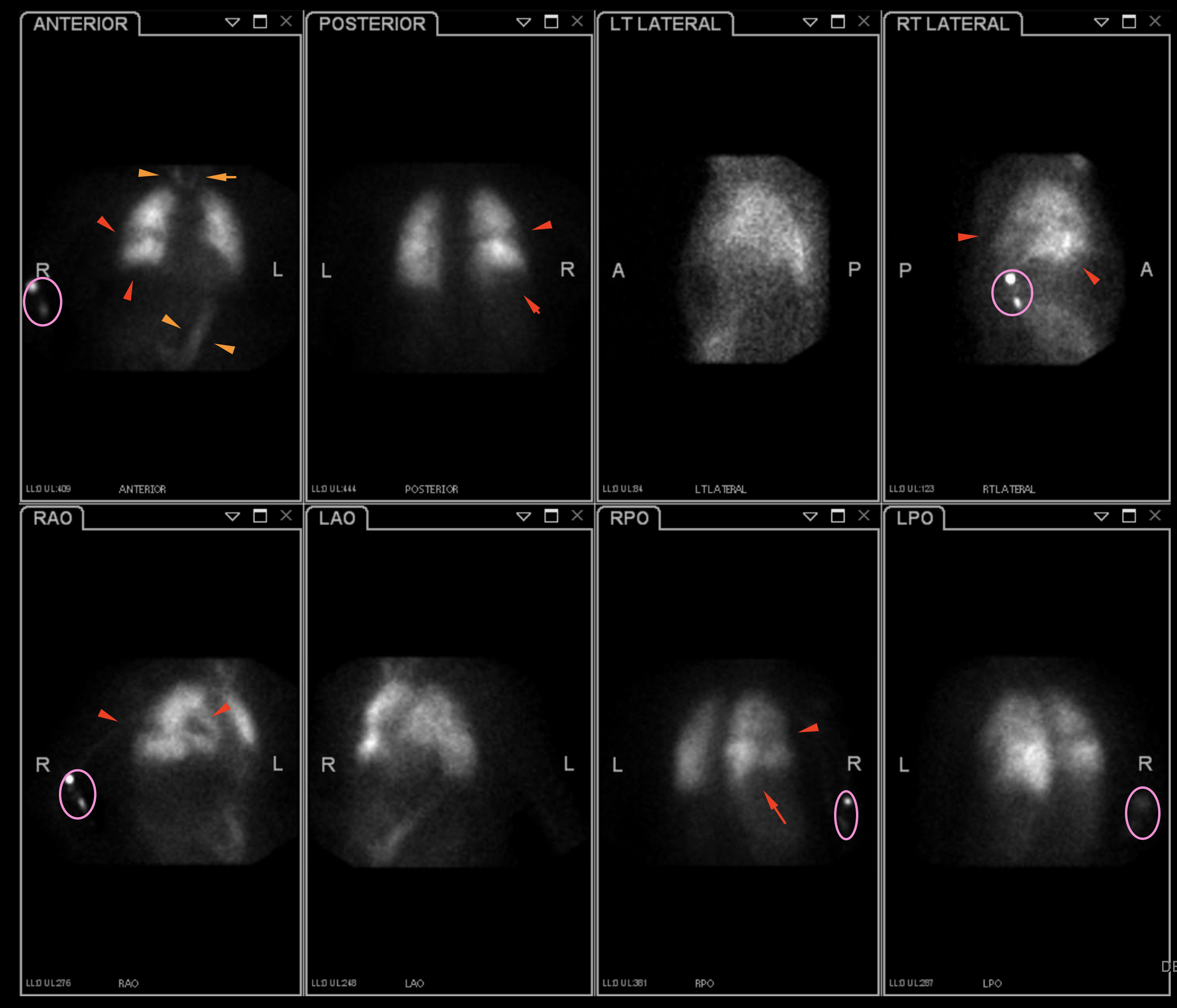 Case #2 | CaseStacks.com