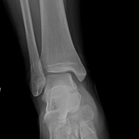 Case #26 - CaseStacks.com