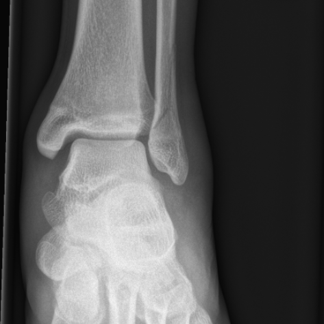 Case #1 - CaseStacks.com