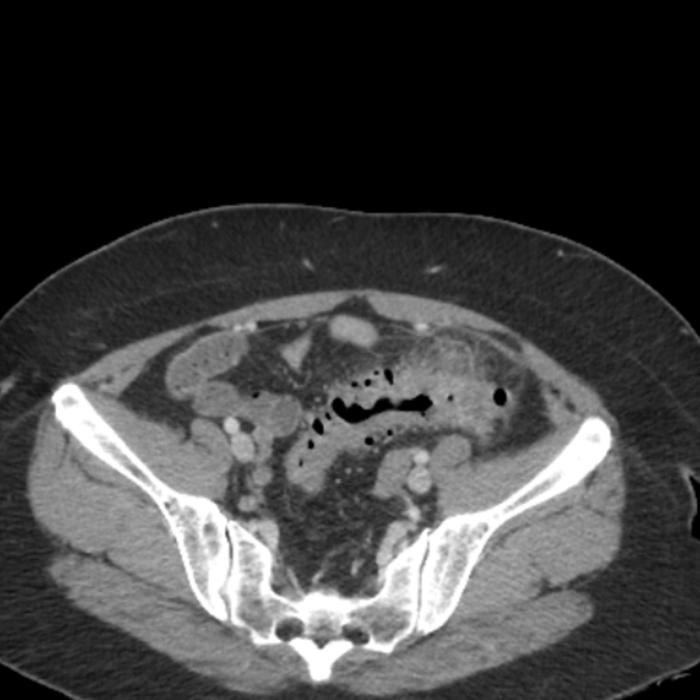 Case #10 - CaseStacks.com