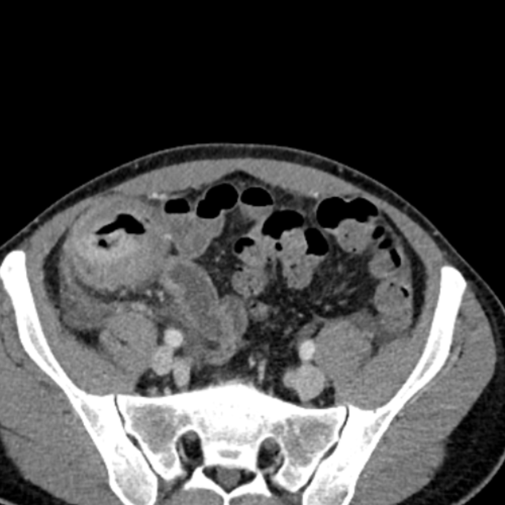 Case #12 - CaseStacks.com