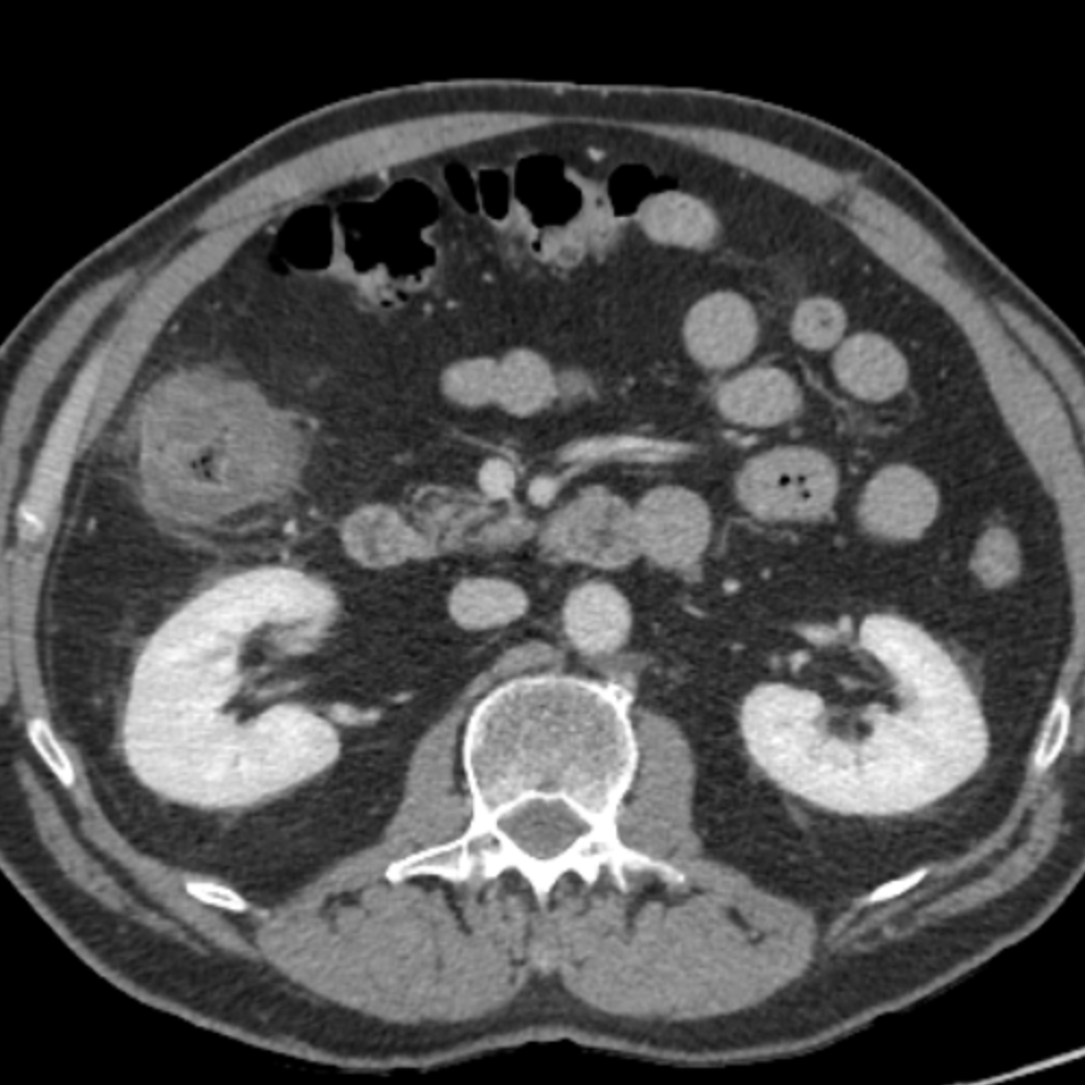 Case #13 - CaseStacks.com