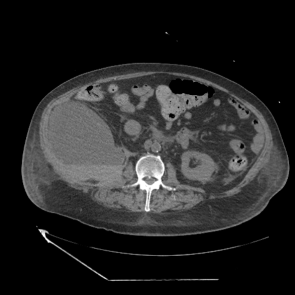 Case #19 - CaseStacks.com