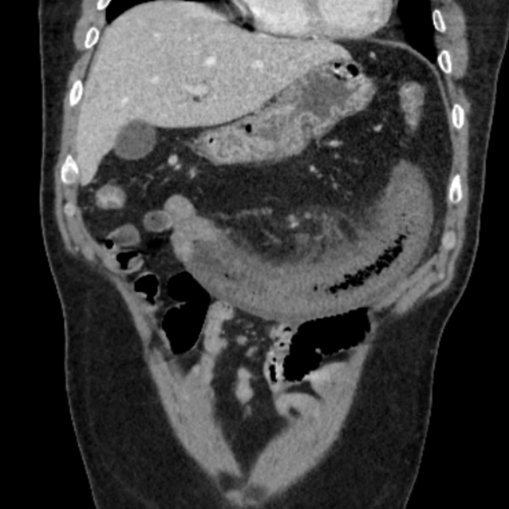 Case #19 - CaseStacks.com