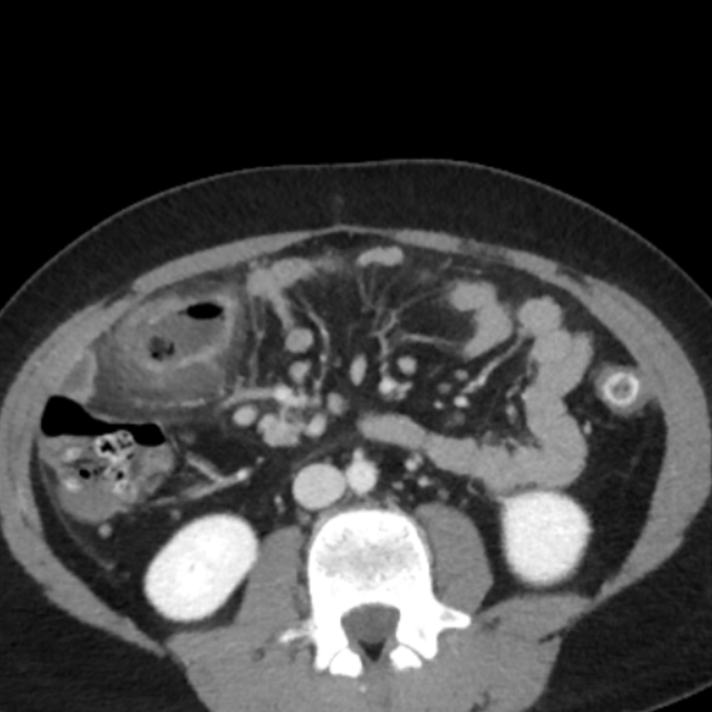 Case #2 - CaseStacks.com
