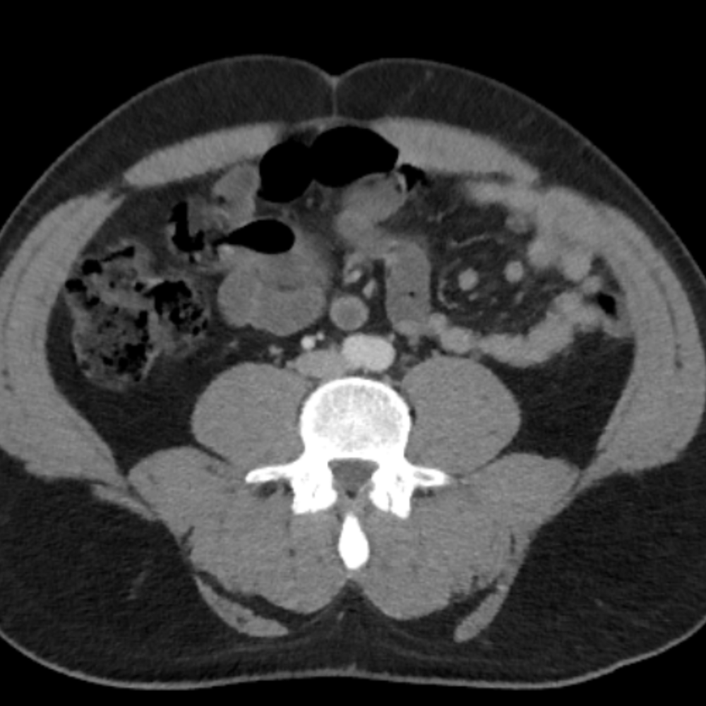 Case #21 - CaseStacks.com